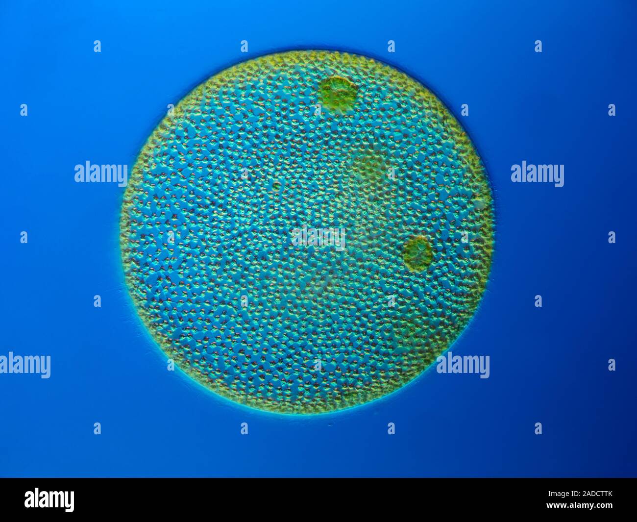 Differential Interference Contrast (DIC) light micrograph of a volvox ...
