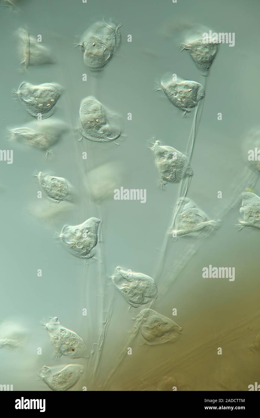 Vorticella protozoa, light micrograph. These ciliate protozoa consist ...