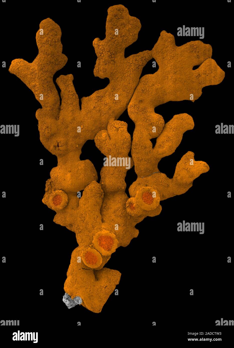 Coloured scanning electron micrograph (SEM) of a Xanthoria elegans ...