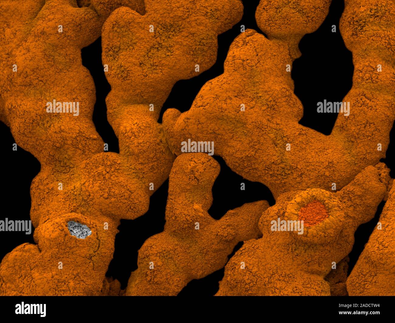 Coloured scanning electron micrograph (SEM) of a Xanthoria elegans ...