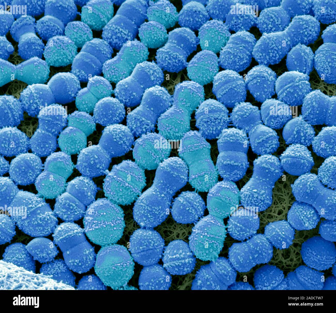 Streptococcus mutans. Coloured scanning electron micrograph (SEM). S ...