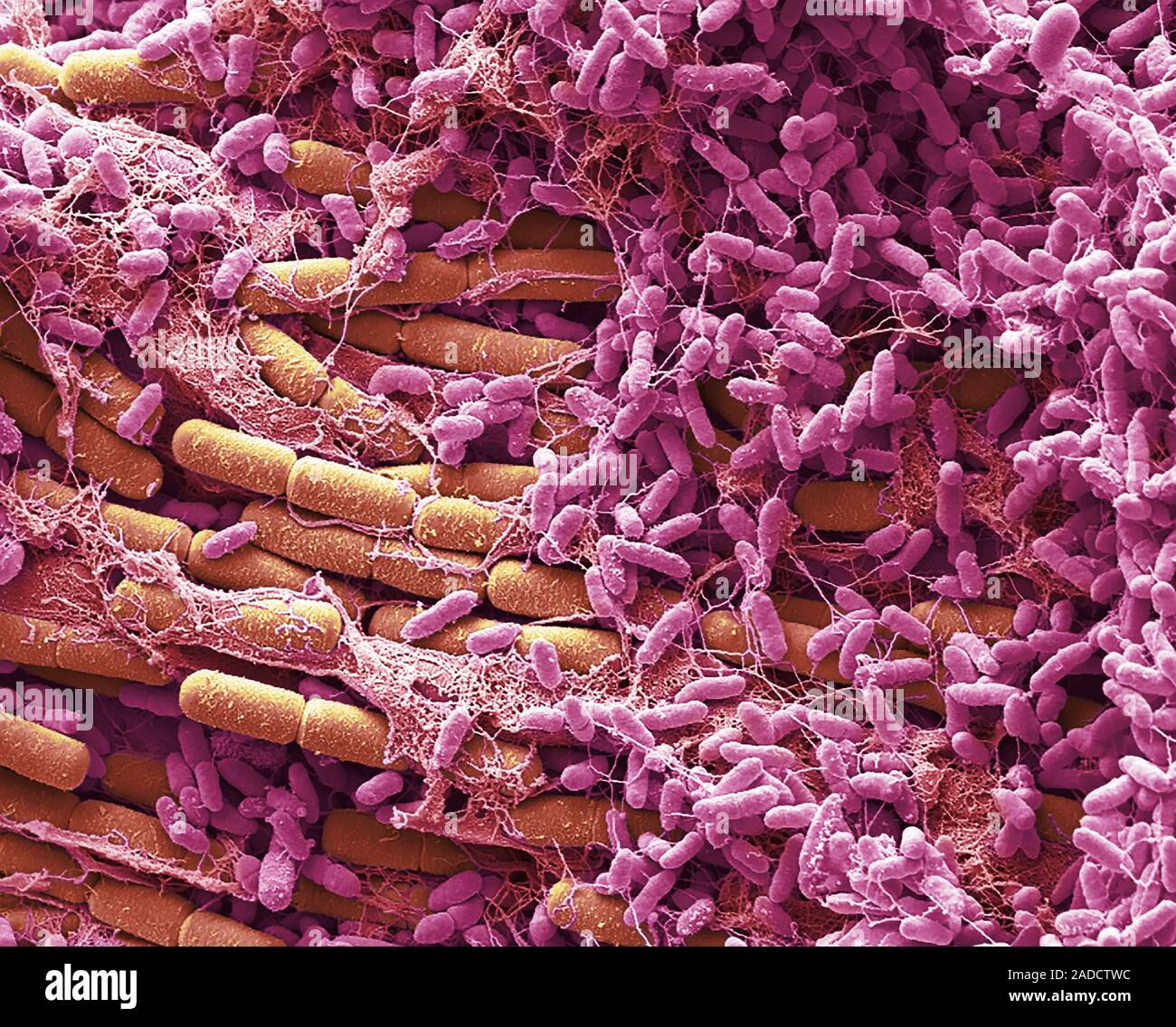 Bacteria from a house fly. Coloured scanning electron micrograph (SEM ...