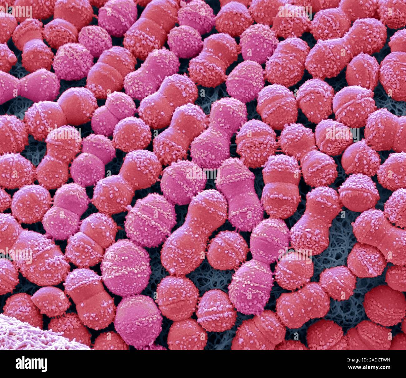 Streptococcus mutans. Coloured scanning electron micrograph (SEM). S ...