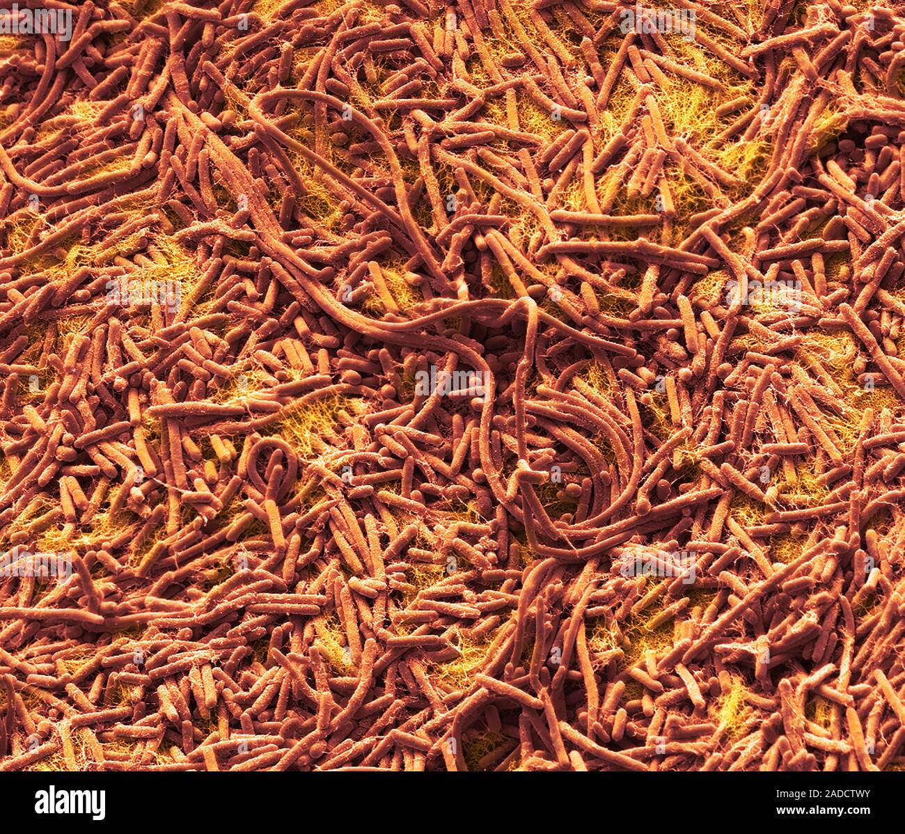 Bacteria from a house fly. Coloured scanning electron micrograph (SEM ...