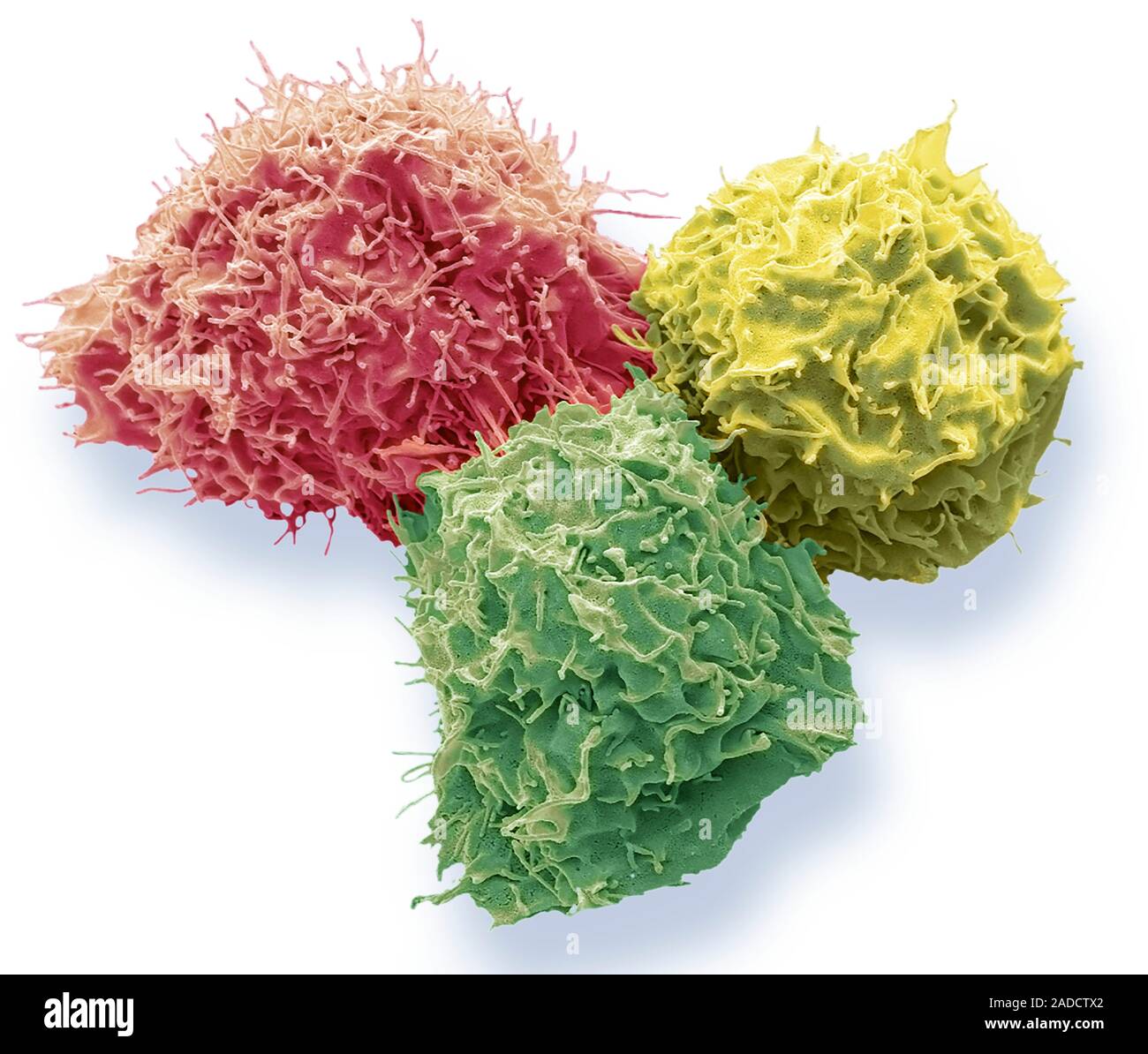 293T cells in culture, coloured scanning electron micrograph (SEM ...
