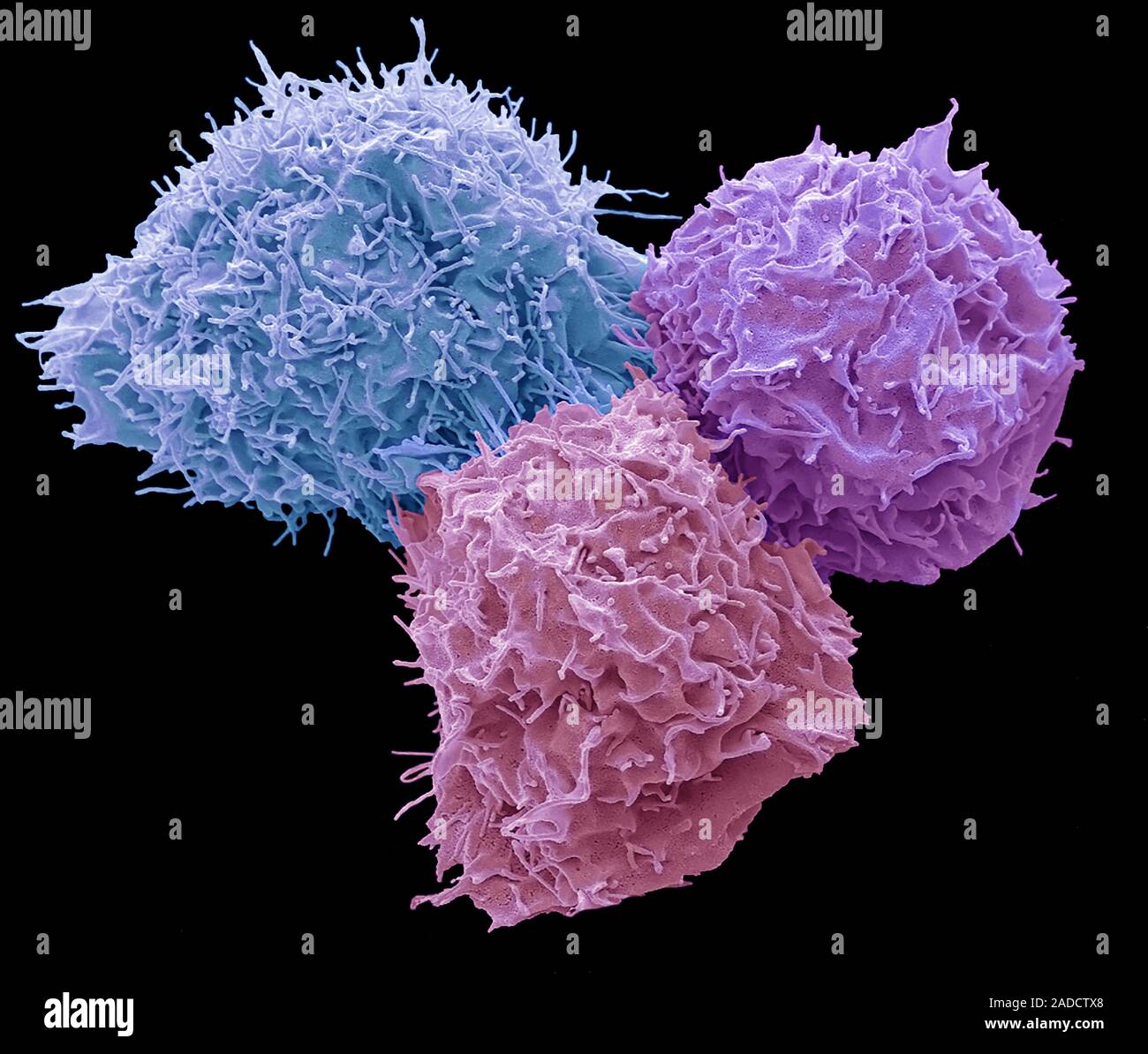 293T cells in culture, coloured scanning electron micrograph (SEM ...