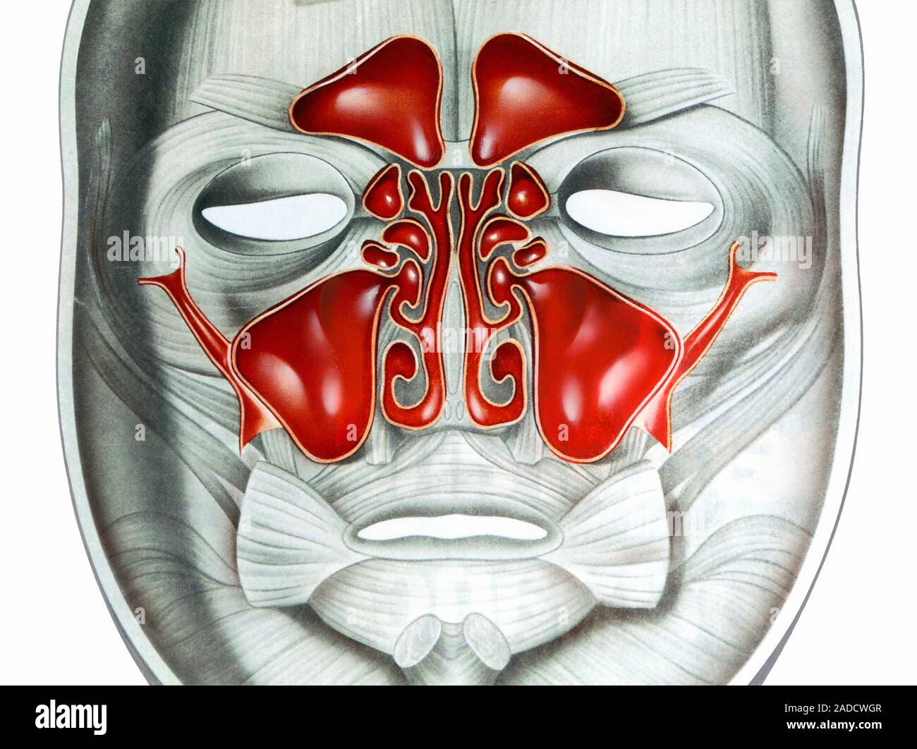 Paranasal sinuses. Illustration of a frontal section through the nasal ...