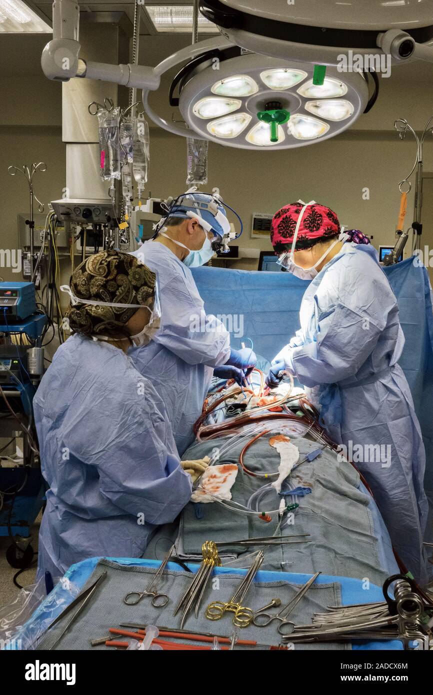Open heart surgery. Members of a cardiac surgery team carrying out open ...