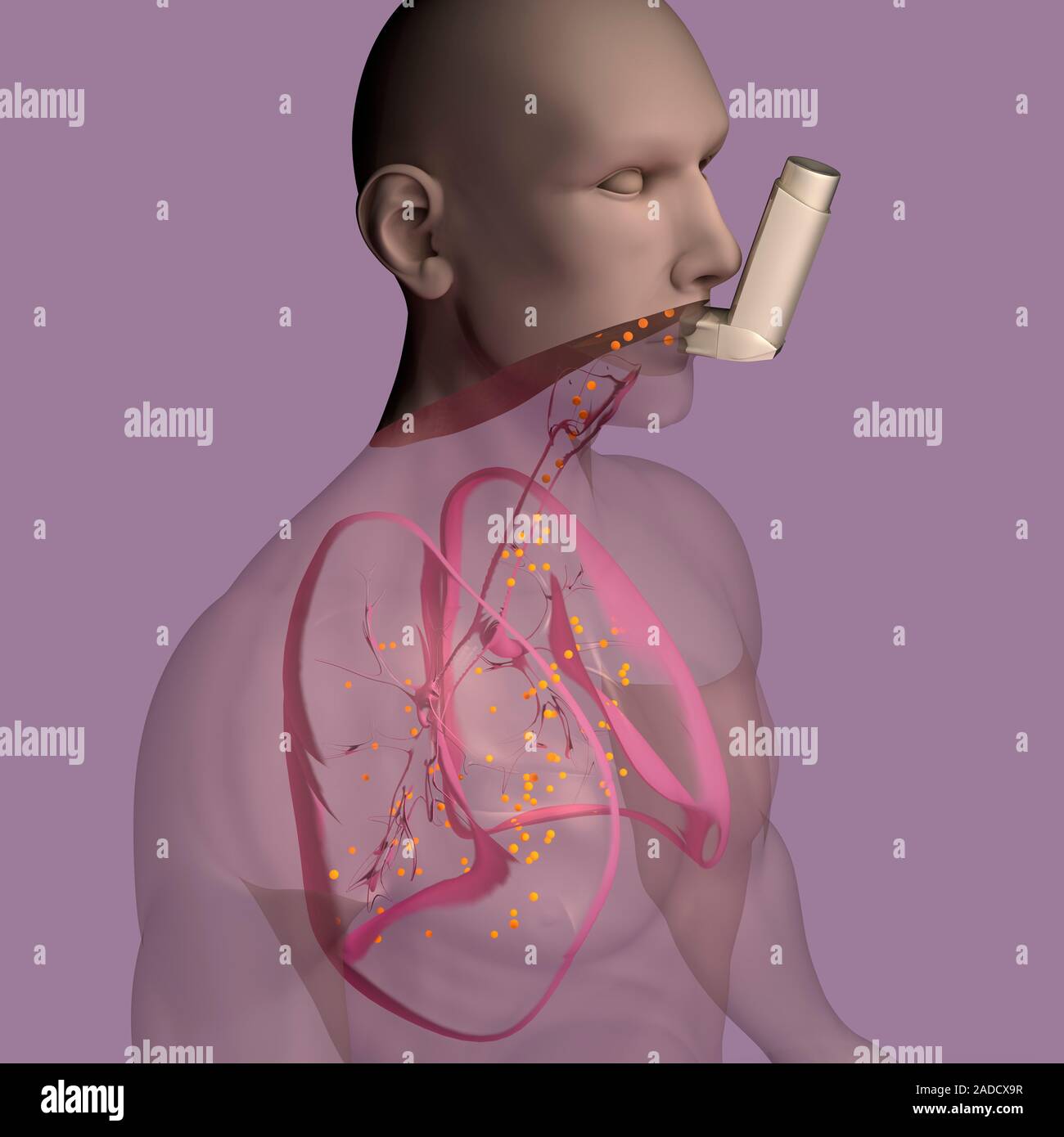 Inhaler use, illustration. This device delivers therapeutic substances ...