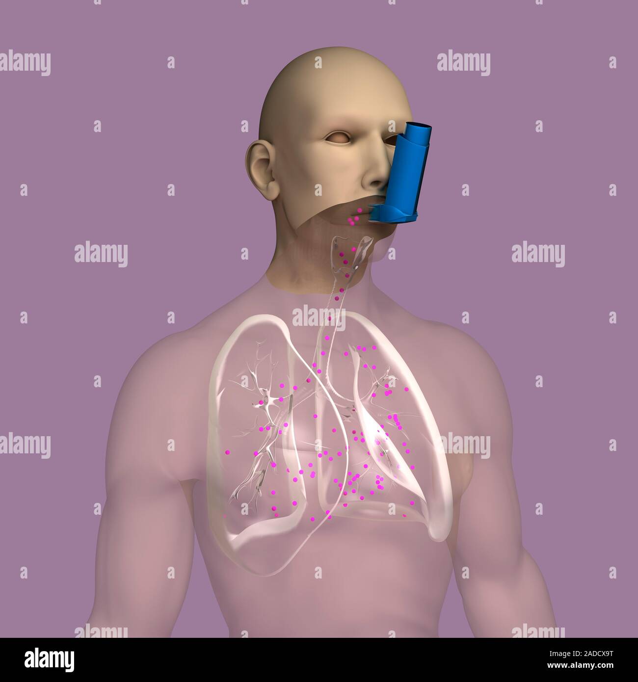 Inhaler use, illustration. This device delivers therapeutic substances ...