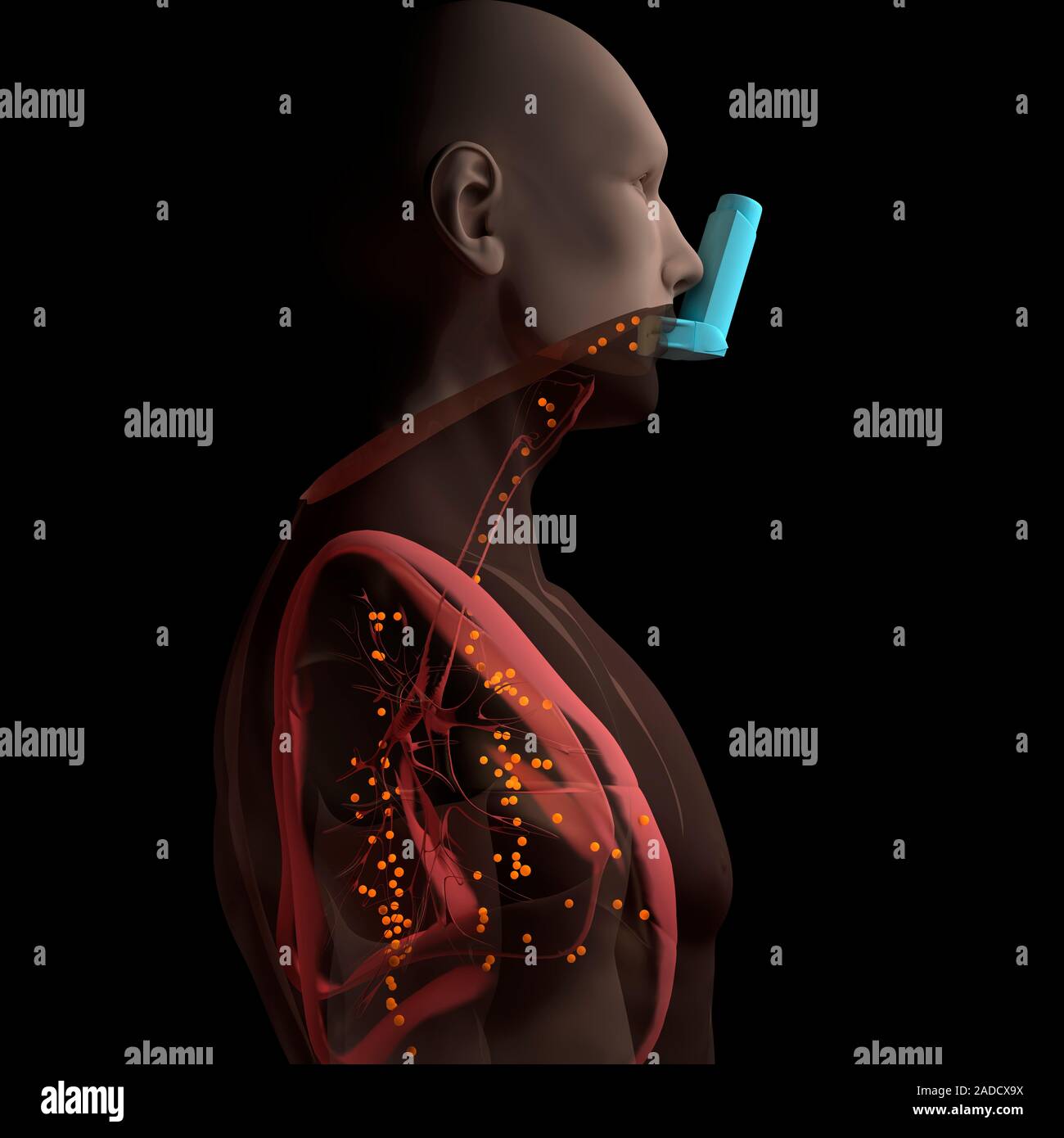 Inhaler use, illustration. This device delivers therapeutic substances ...