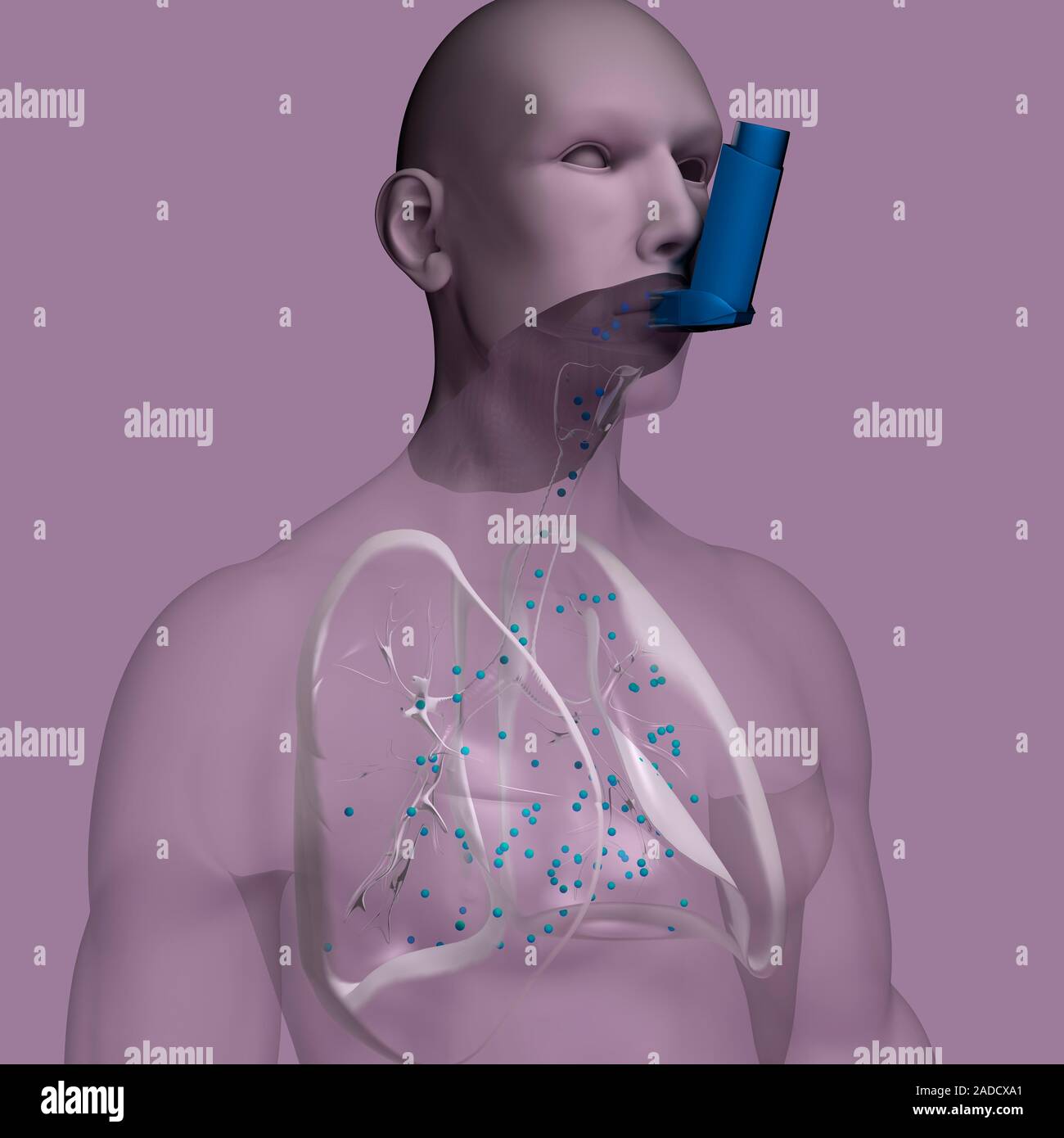 Inhaler use, illustration. This device delivers therapeutic substances ...