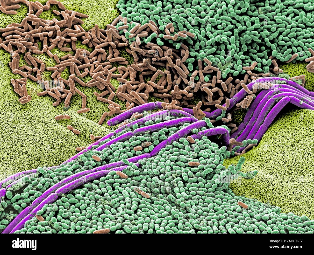 Bacteria from a cat's tongue. Coloured scanning electron micrograph ...