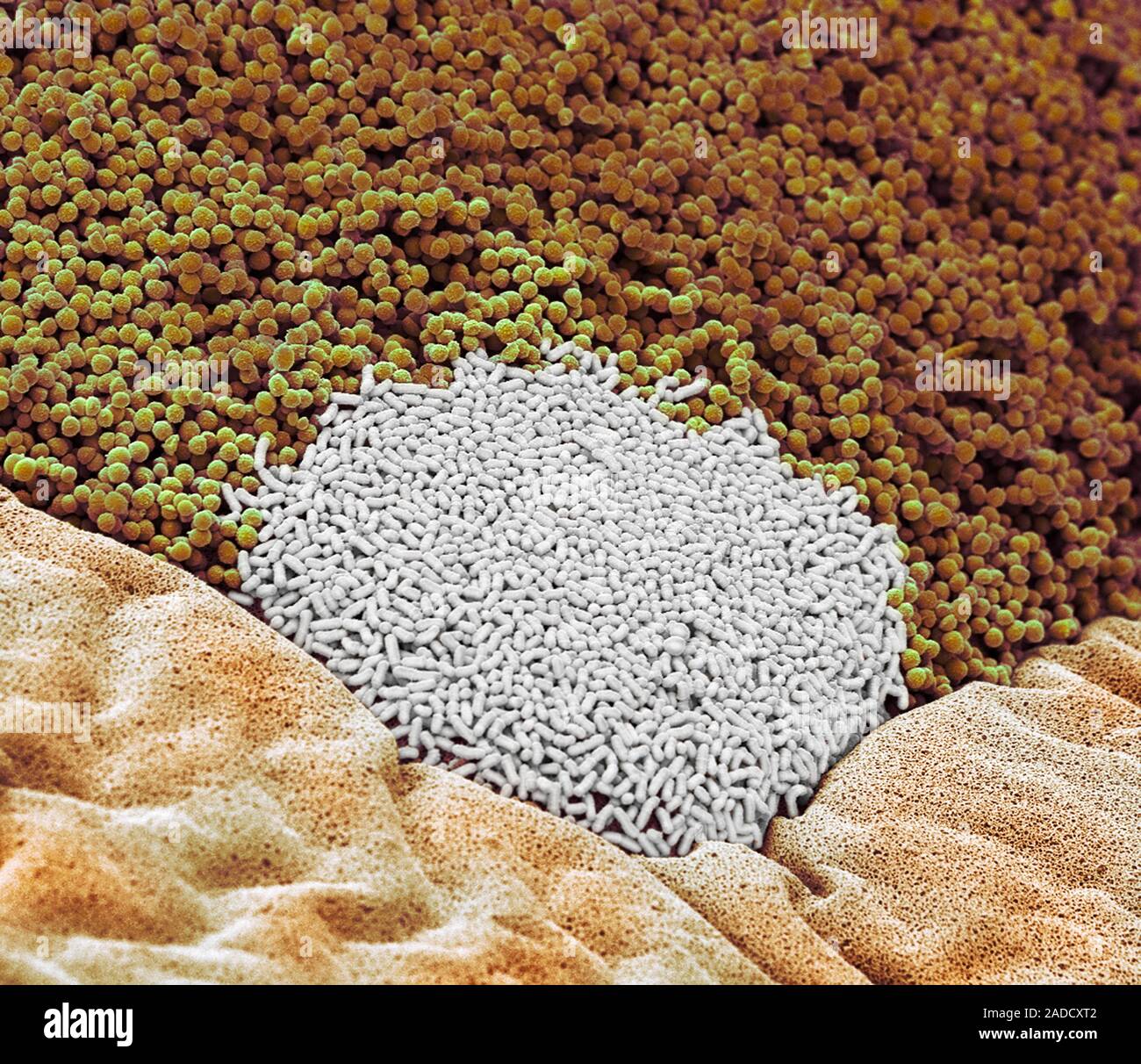 Foot bacteria. Scanning electron micrograph (SEM) of bacteria that live ...