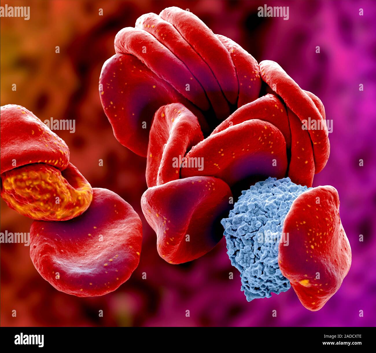 Red and white blood cells. Coloured scanning electron micrograph (SEM ...