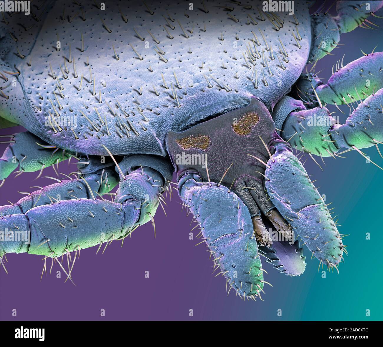 American dog tick (Dermacentor variabilis), coloured scanning electron ...
