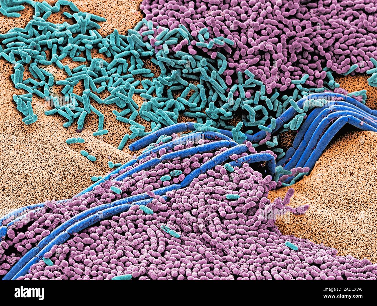 Bacteria from a cat's tongue. Coloured scanning electron micrograph ...