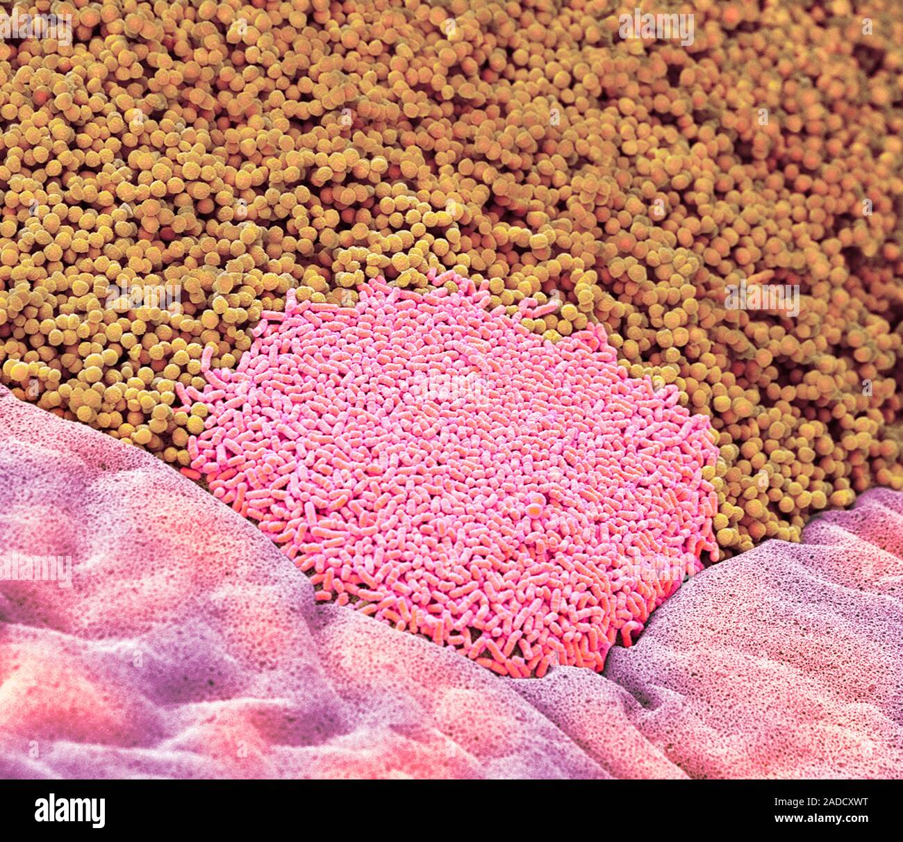 Foot bacteria. Scanning electron micrograph (SEM) of bacteria that live ...