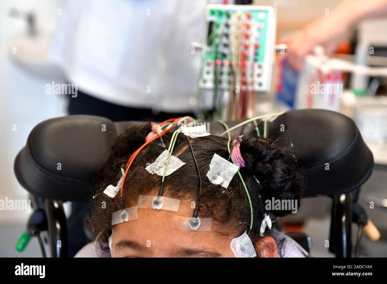 Electroencephalography test in cerebral palsy. 12-year-old girl with ...