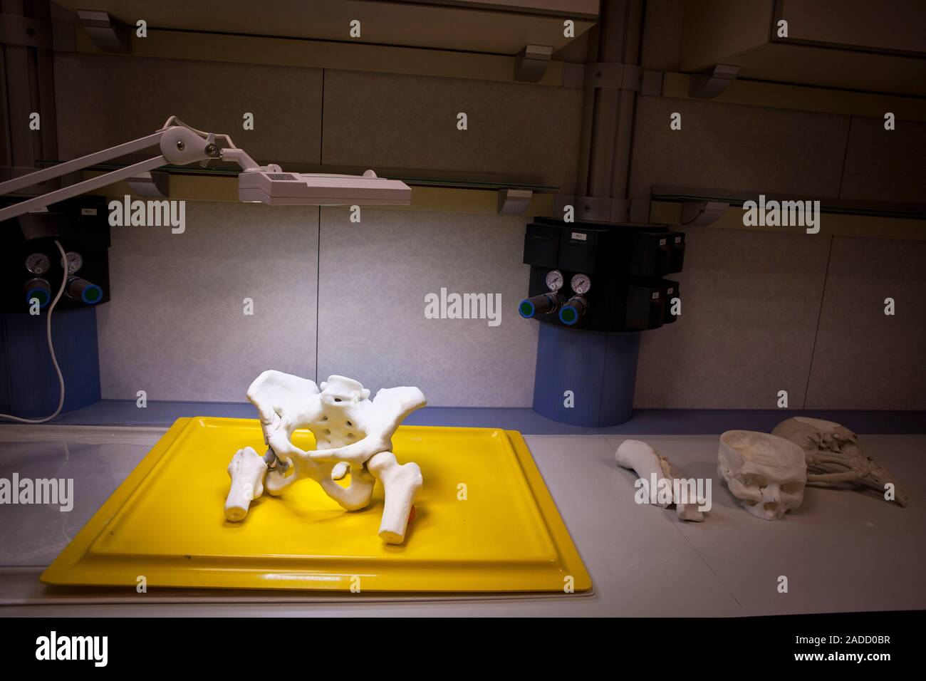 3D printed bone implants. 3D printed model of a human pelvis (left ...