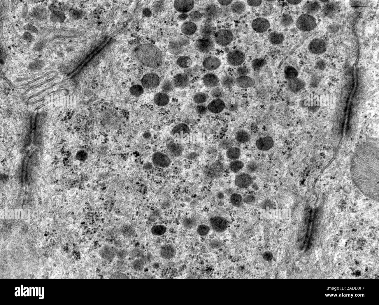 Transmission electron micrograph (TEM) showing the cytoplasm of a ...