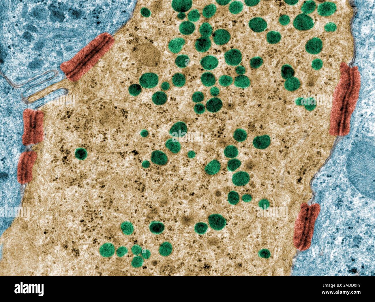 Coloured transmission electron micrograph (TEM) showing the cytoplasm (light brown) of a ...