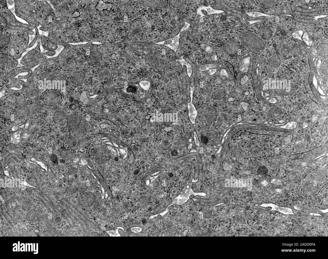 Transmission electron micrograph (TEM) showing chylomicrons ...