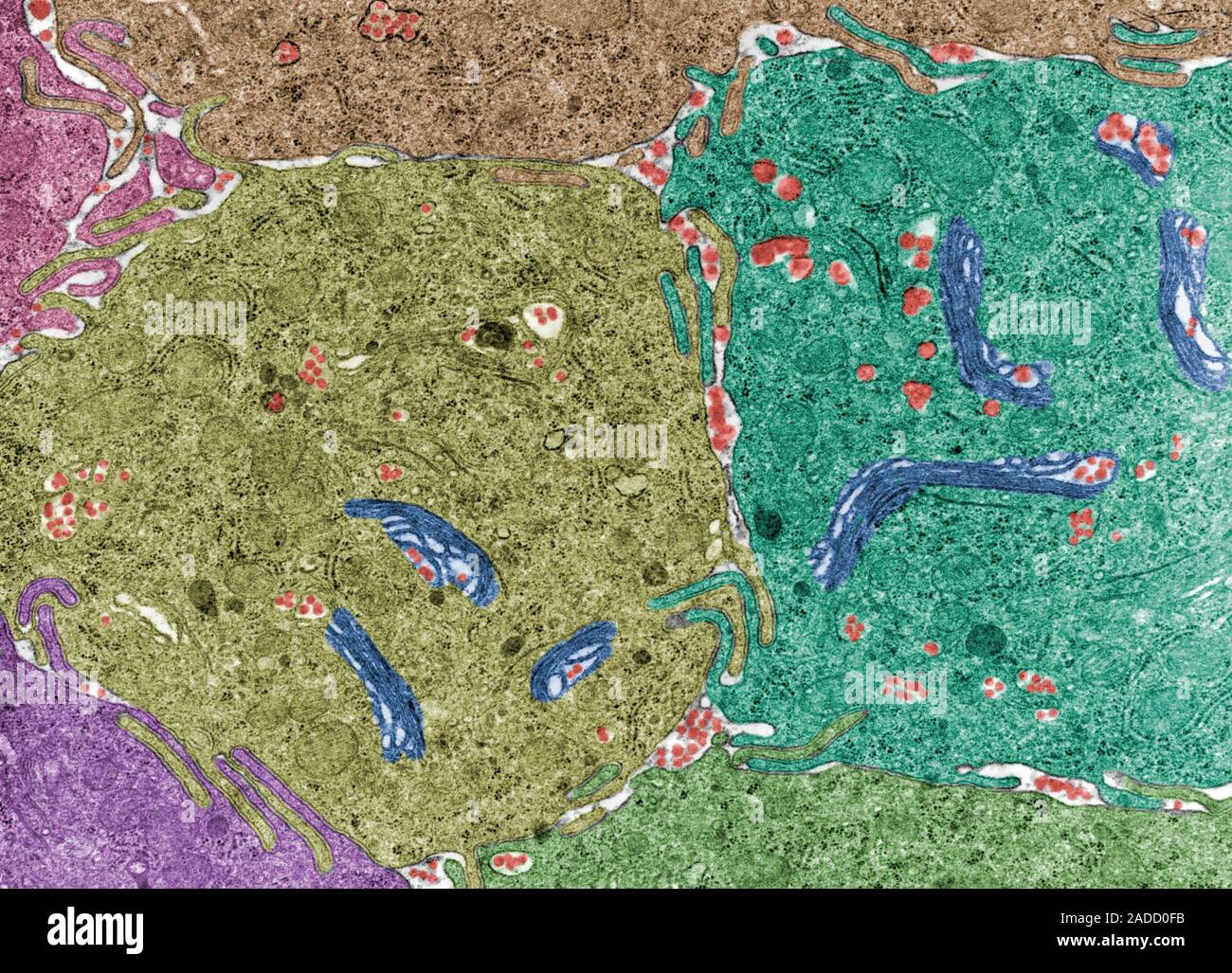 Coloured transmission electron micrograph (TEM) showing chylomicrons ...