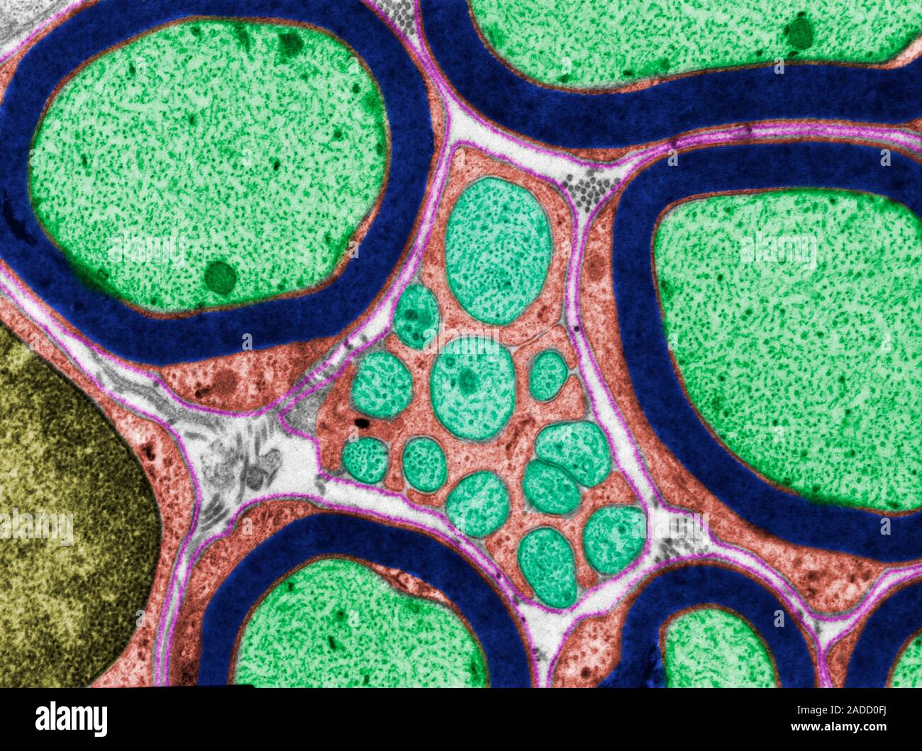 Coloured transmission electron micrograph (TEM) showing several unmyelinated (green) and ...