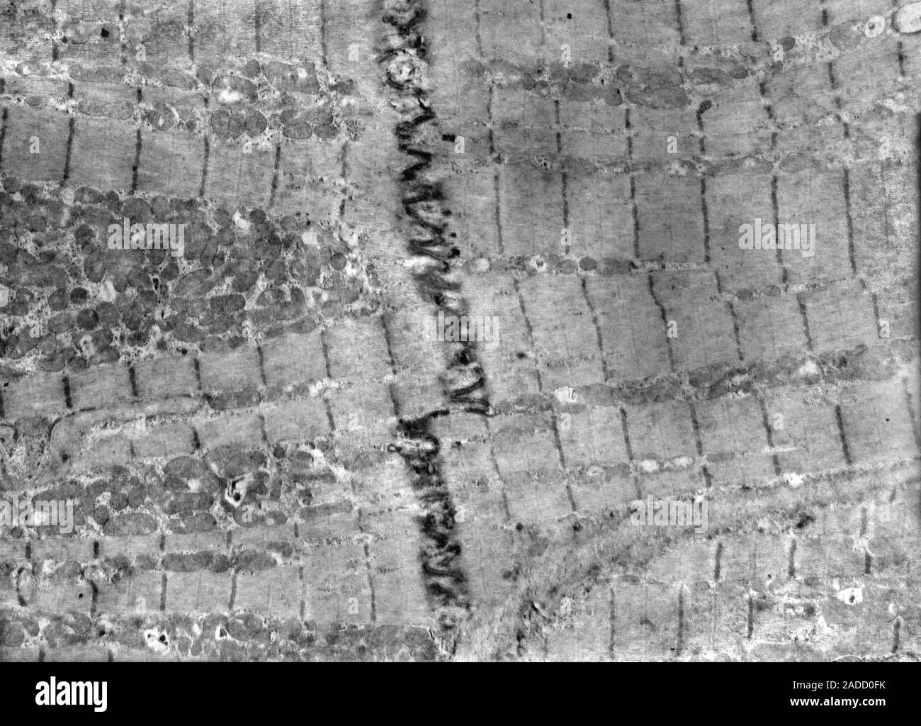Transmission electron micrograph (TEM) showing two heart muscle cells ...
