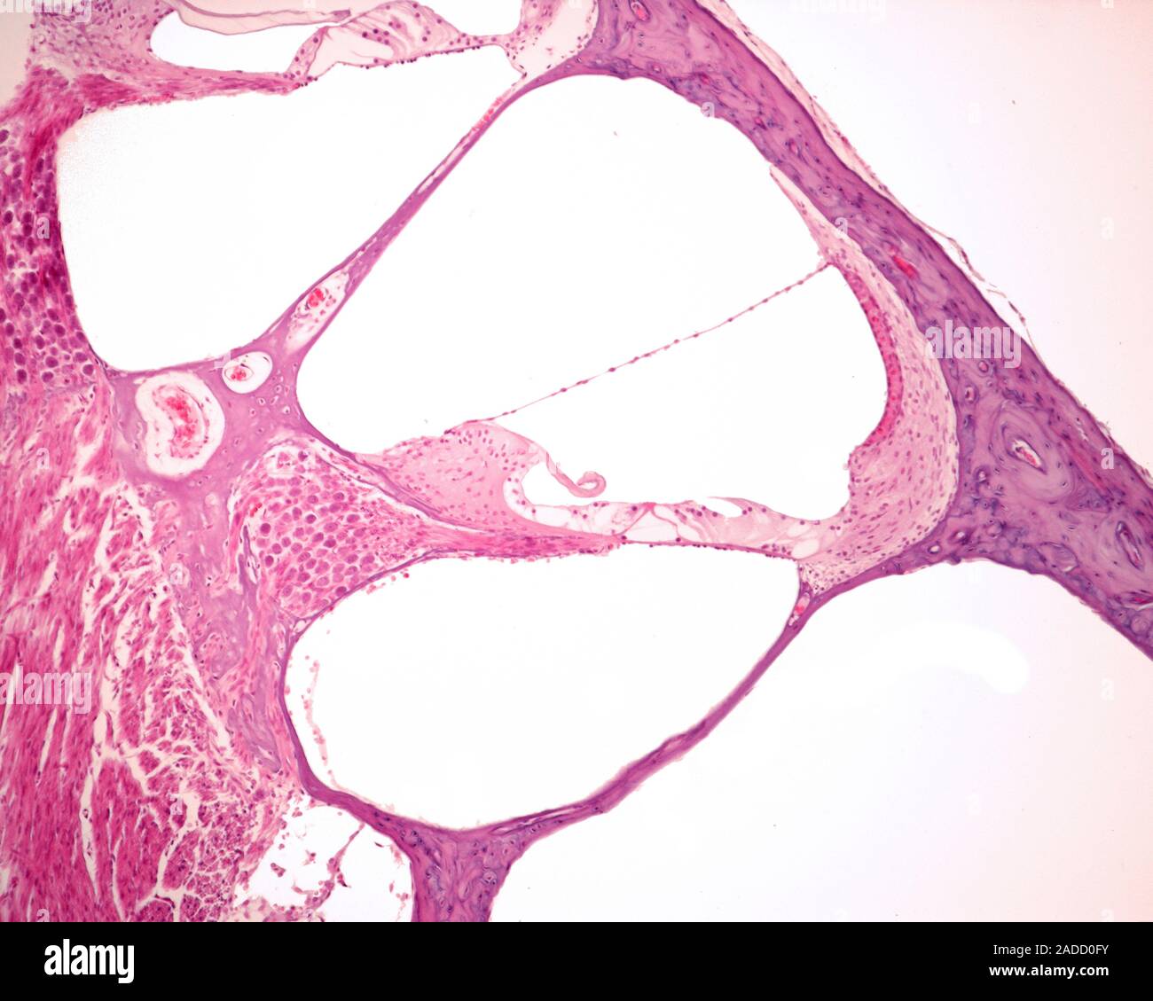 Light micrograph of a cross section of the cochlea of the inner ear ...