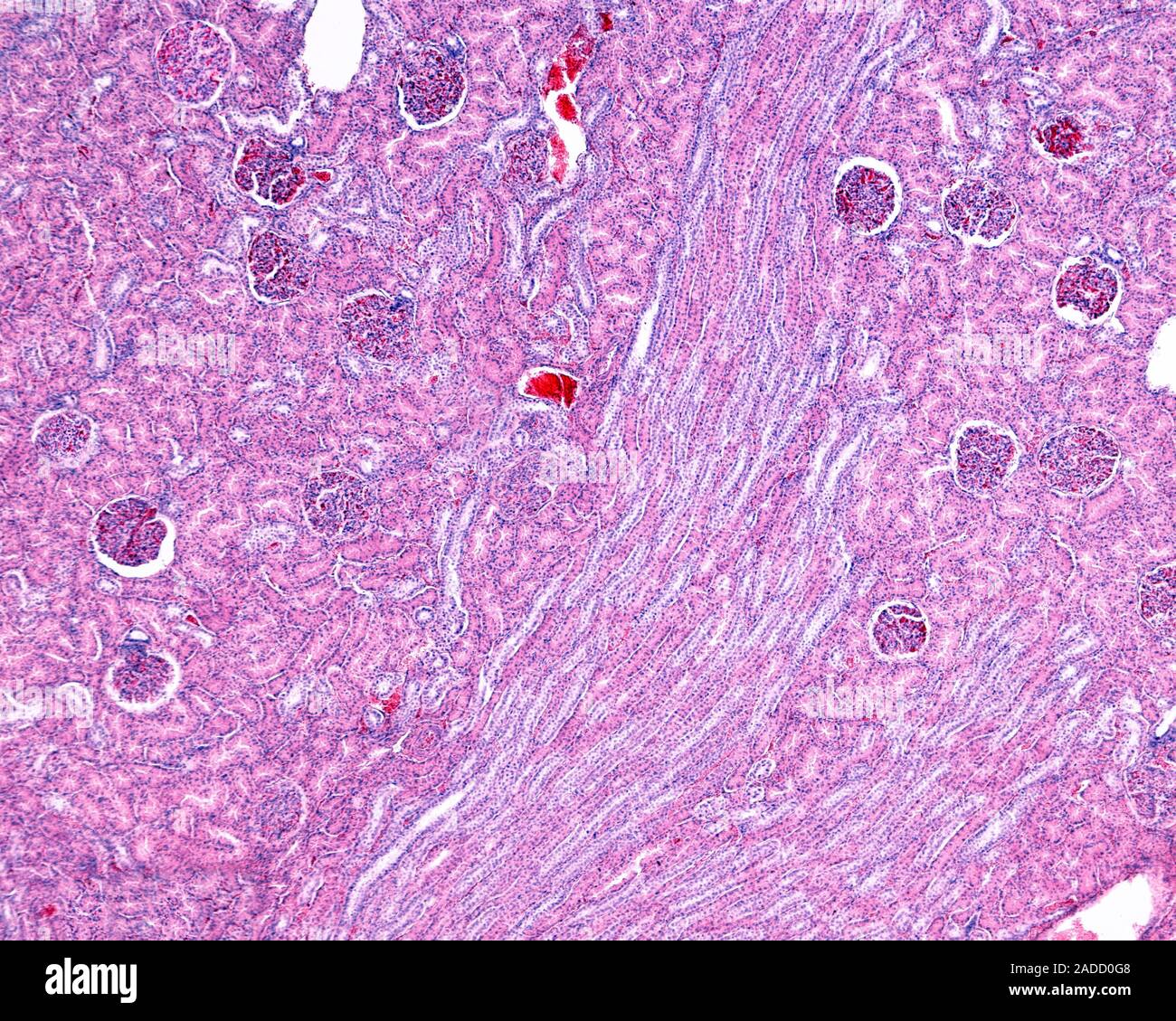 Low magnification light micrograph showing several glomeruli and ...