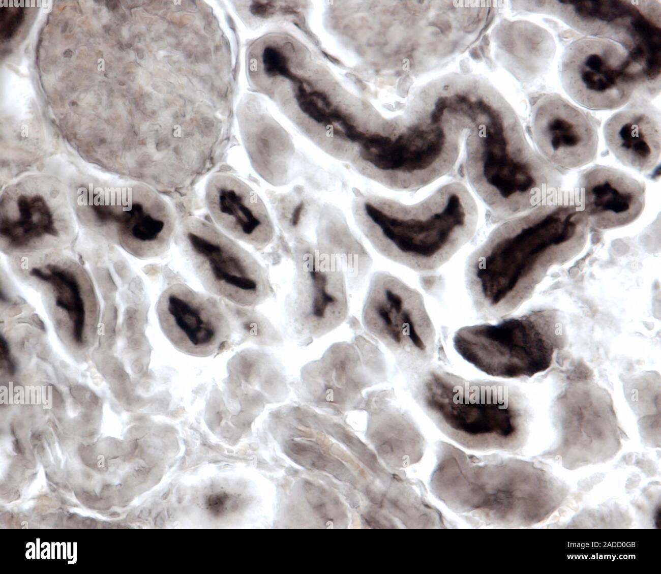 Kidney proximal convoluted tubule, light micrograph. The main ...