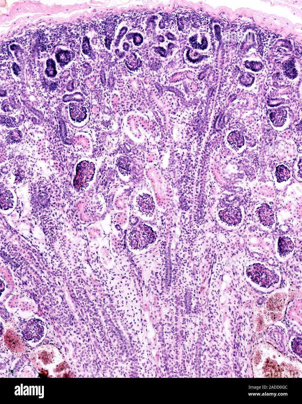 Light micrograph of the renal cortex from a 20 week old foetus. Beneath ...
