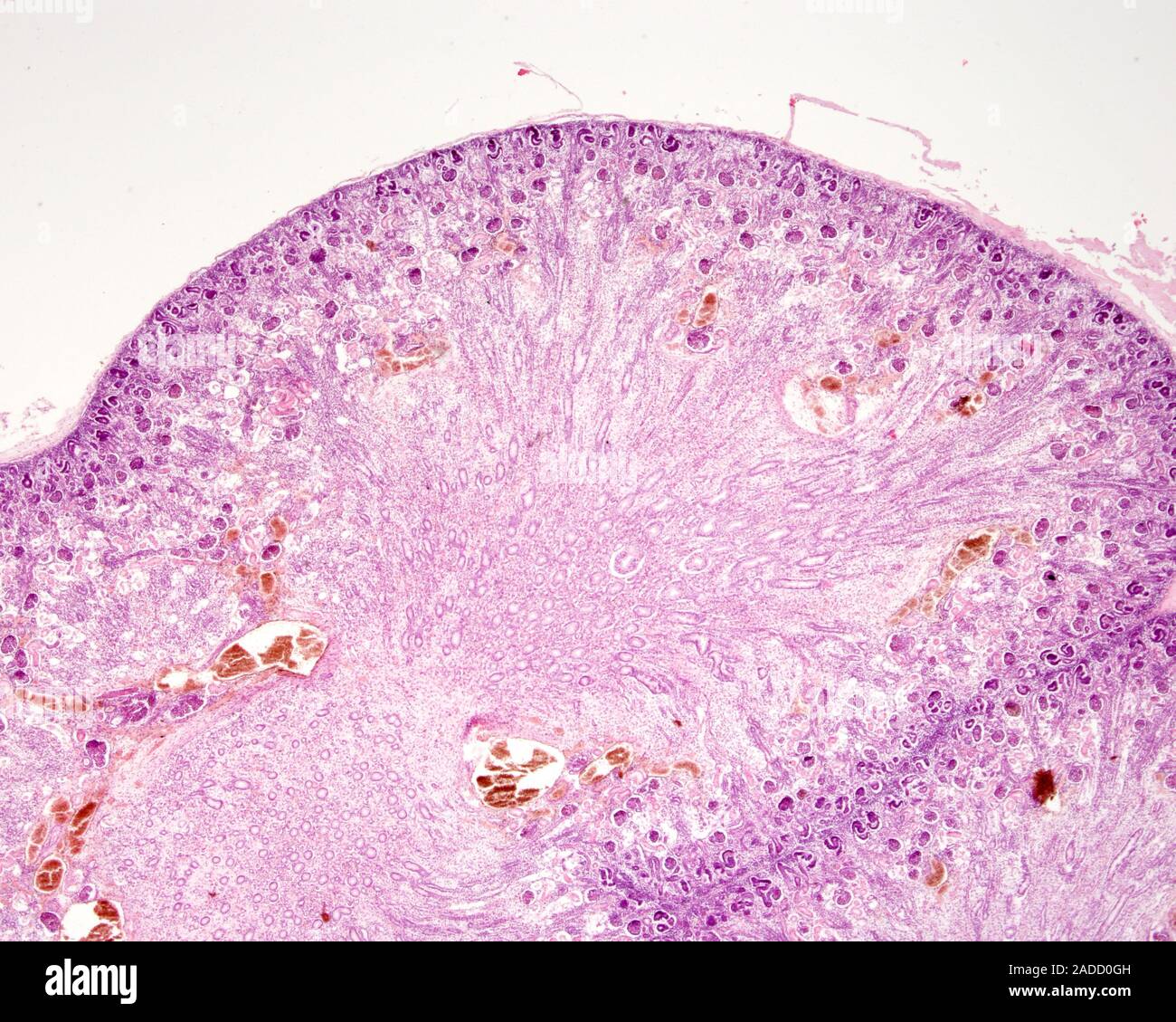 Low power light micrograph of a kidney from a 20 week old foetus ...