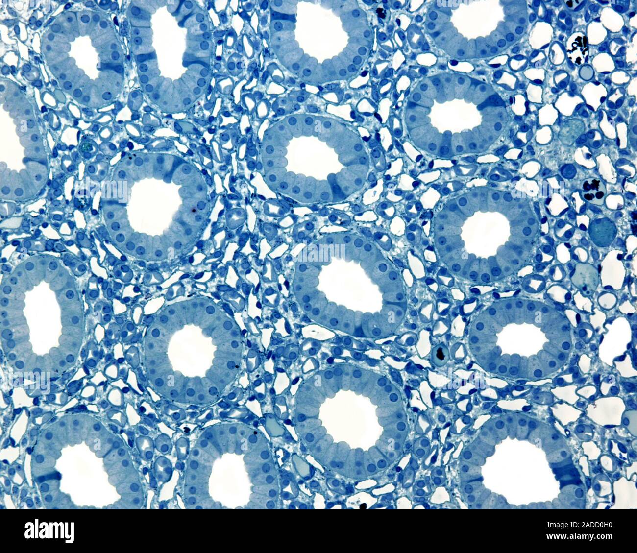 Light micrograph of a renal medulla showing several collecting ducts ...