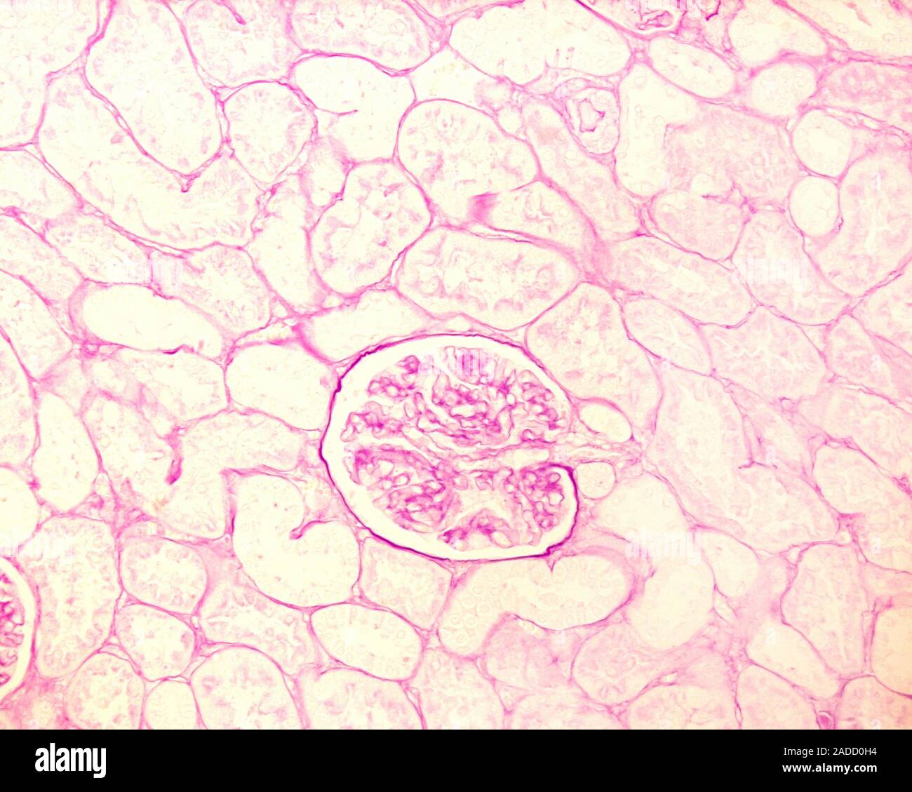 Light micrograph od a section of human kidney stained with PAS ...