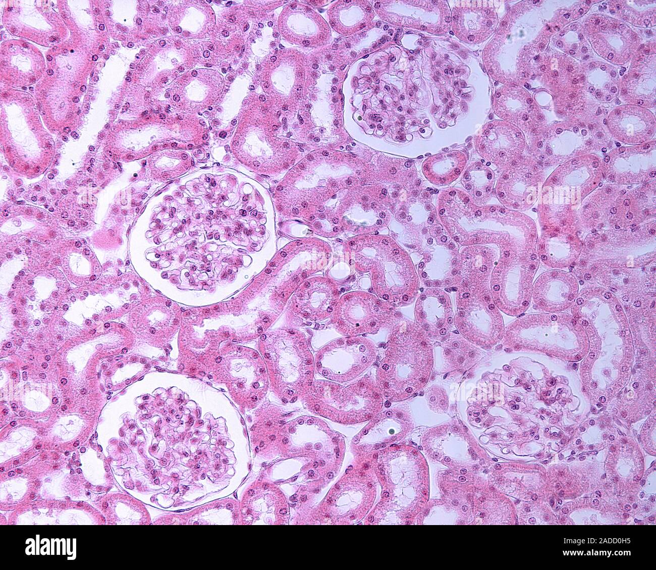 Parenchyma Kidney