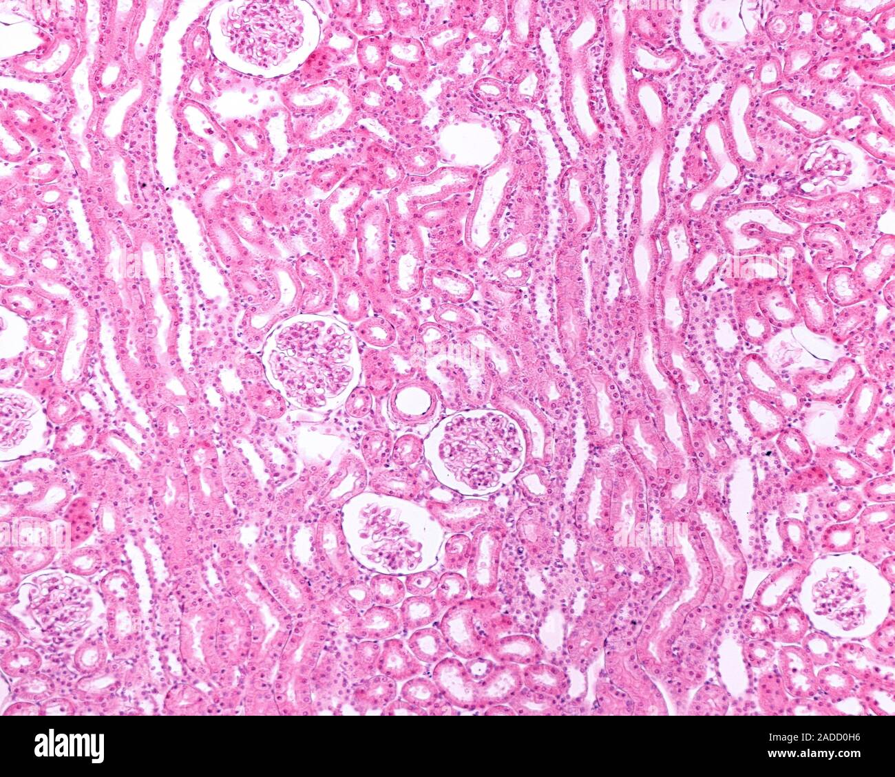 Kidney cortex, light micrograph. The cortex consists of the cortical ...