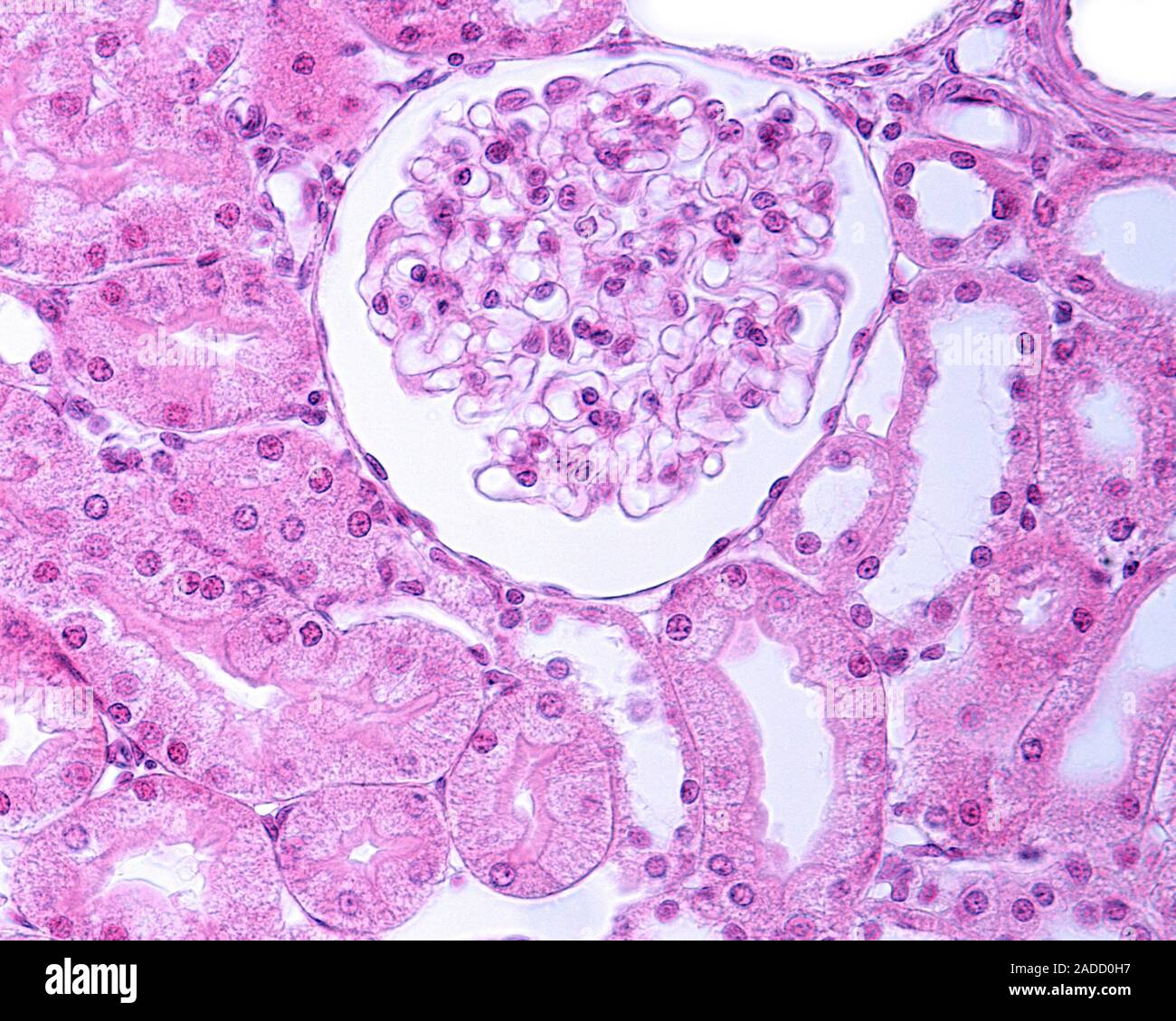 Light micrograph of the renal cortex of a kidney that has been fixed by ...