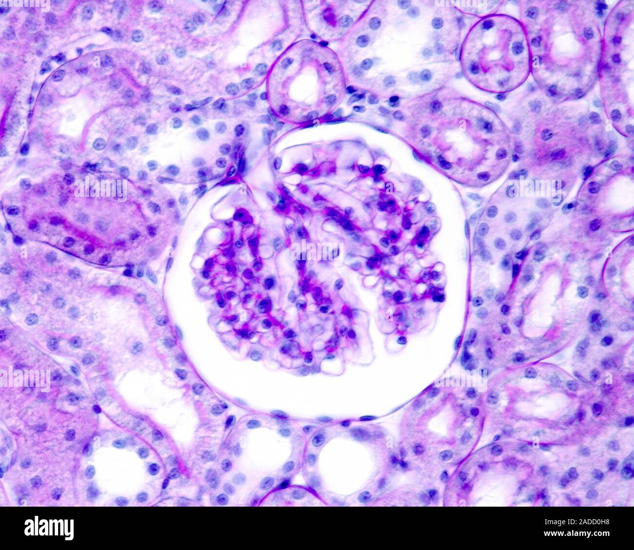 Light micrograph of a normal glomerulus with PAS stain. The PAS method ...