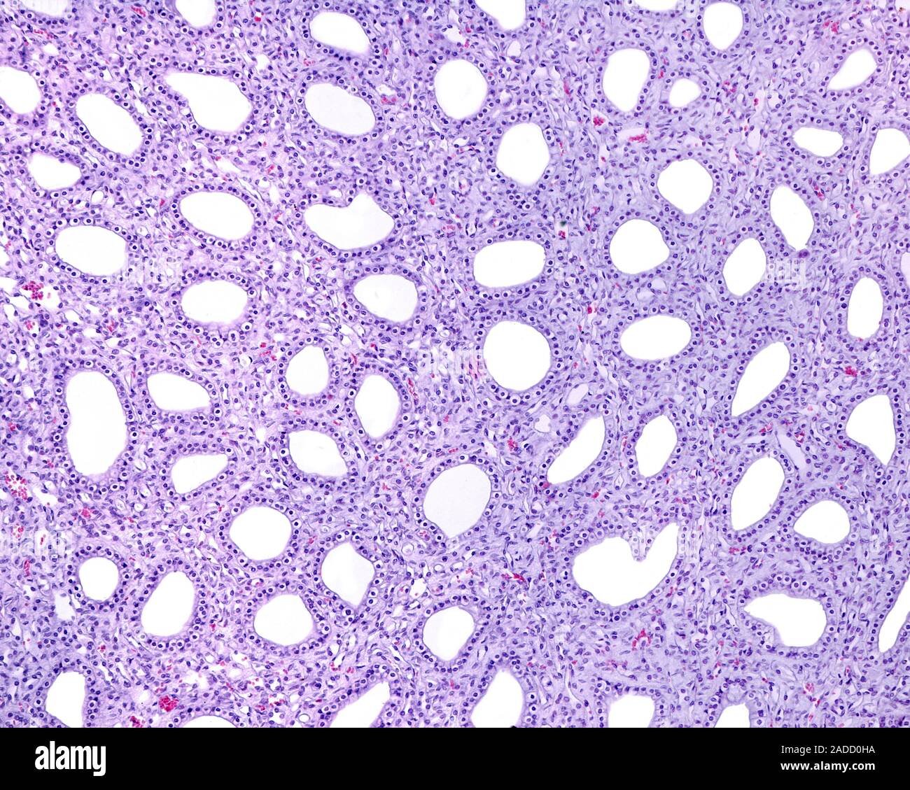 Low power light micrograph of a kidney medulla stained with H&E. The ...
