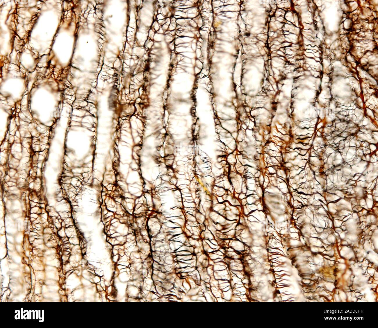 Kidney medulla, light micrograph. The renal tubules of the nephron are ...