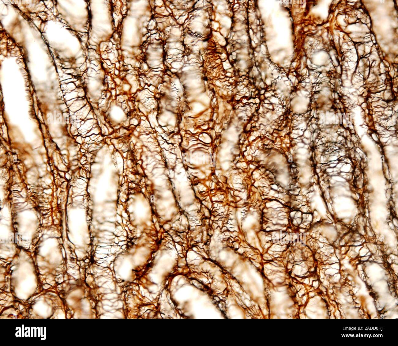 Kidney medulla, light micrograph. The renal tubules of the nephron are ...