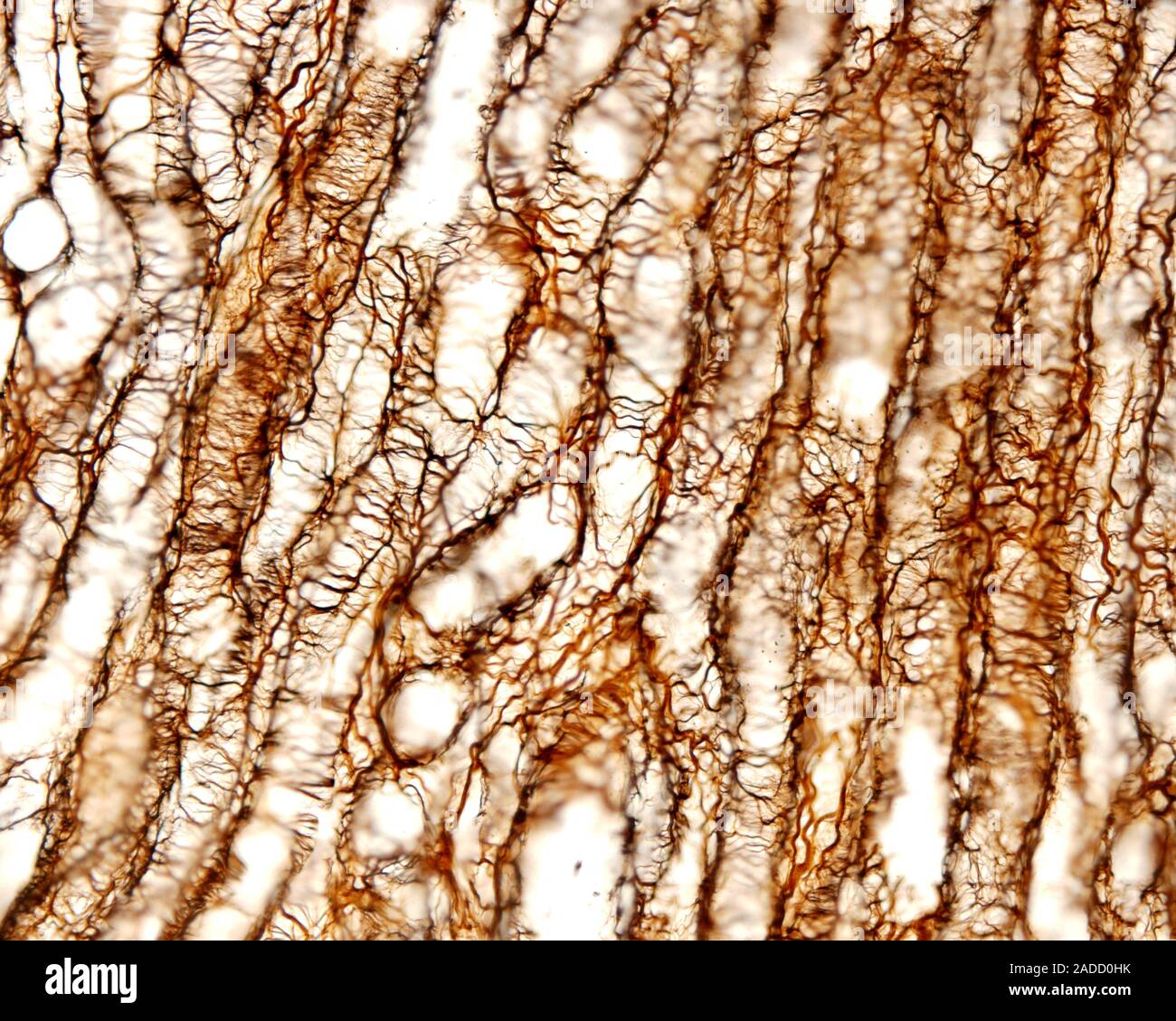 Kidney medulla, light micrograph. The renal tubules of the nephron are ...