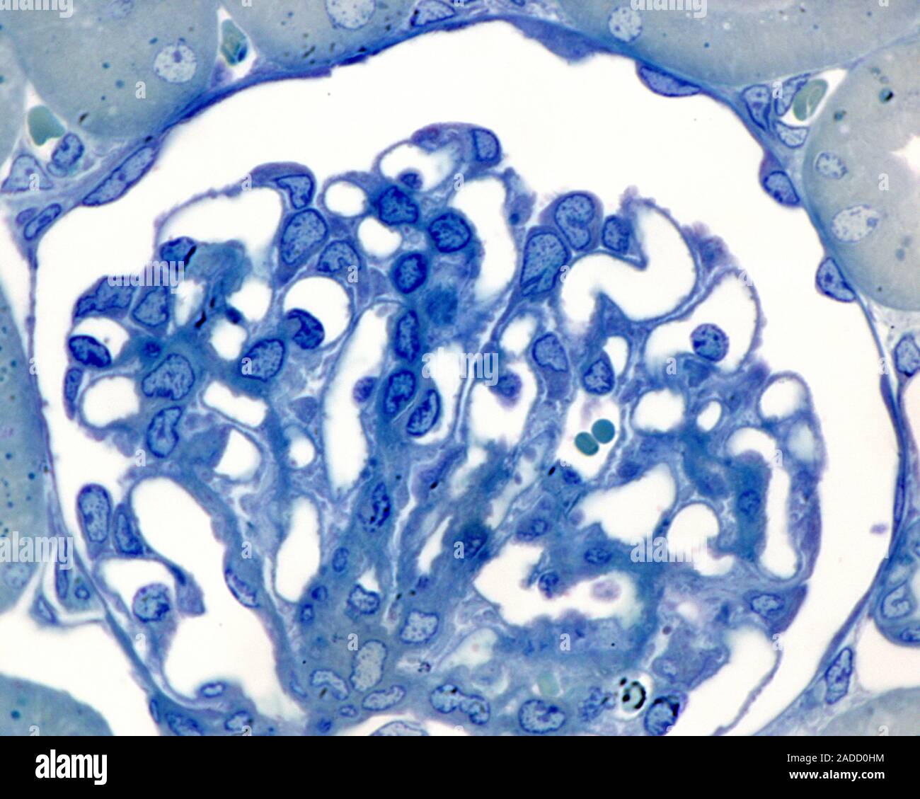 Light micrograph of a glomerulus. The capillary loops, podocytes ...