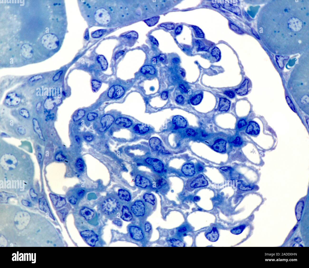 Light micrograph of a glomerulus. The capillary loops, podocytes and ...