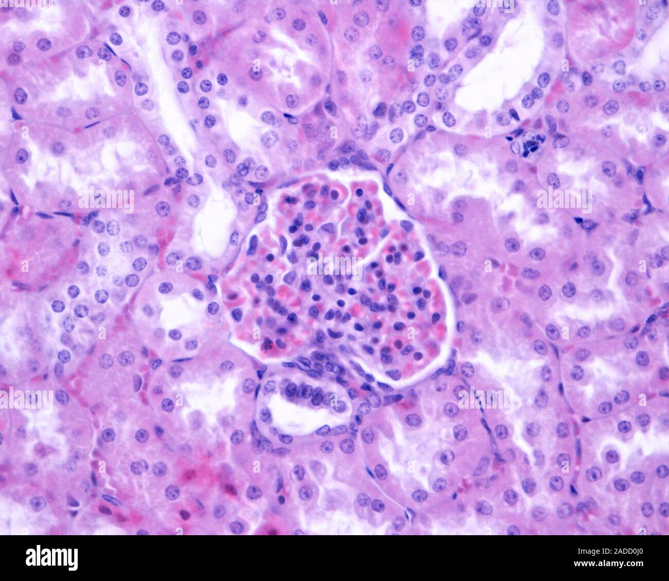 High magnification light micrograph of a human kidney stained with H&E ...