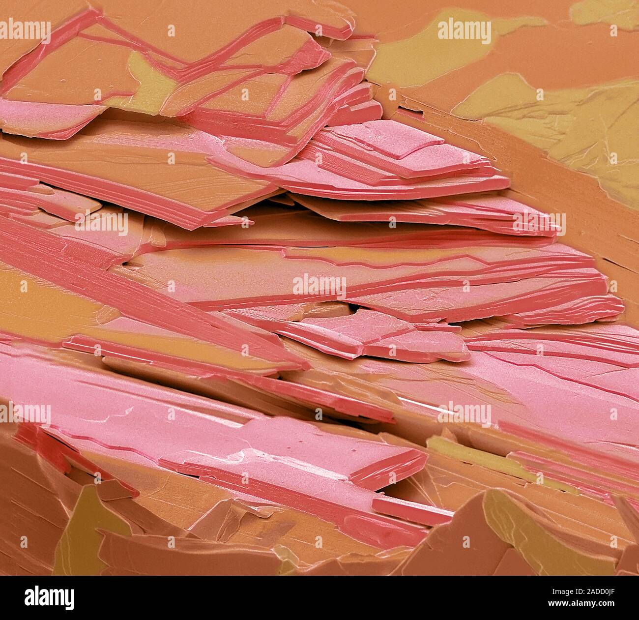 Gallstone crystals. Coloured scanning electron micrograph (SEM) of the ...