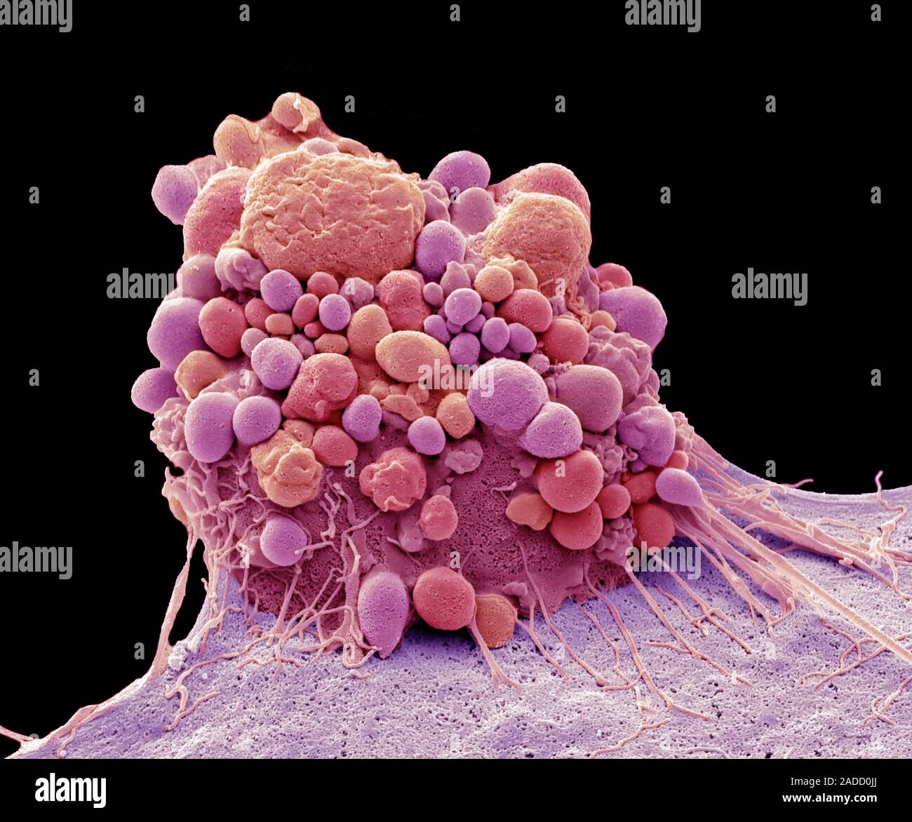 Apoptosis. Coloured scanning electron micrograph (SEM) of a brain ...